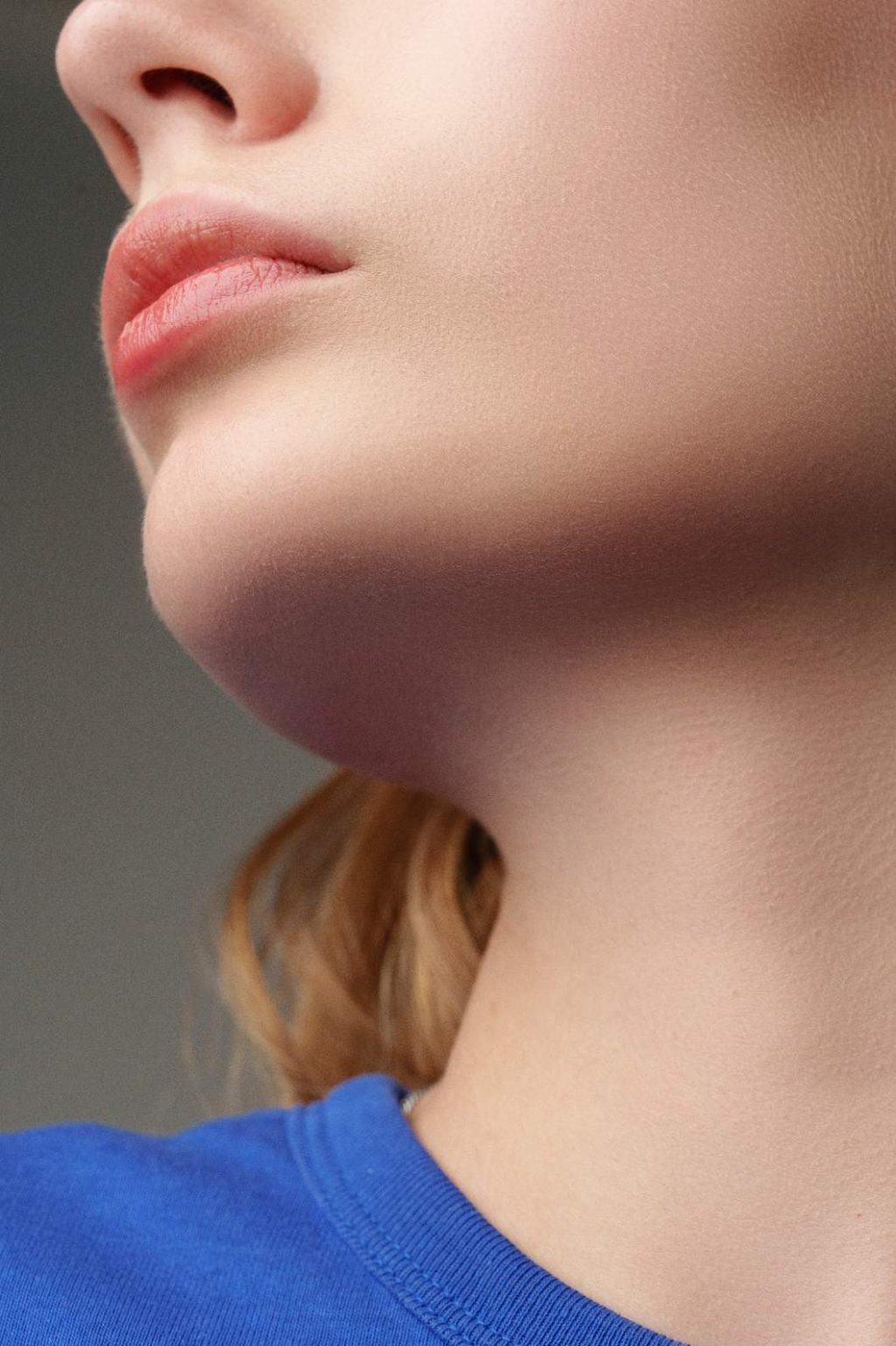 Chin Fillers Gone Wrong: Complications and How to Fix Them
