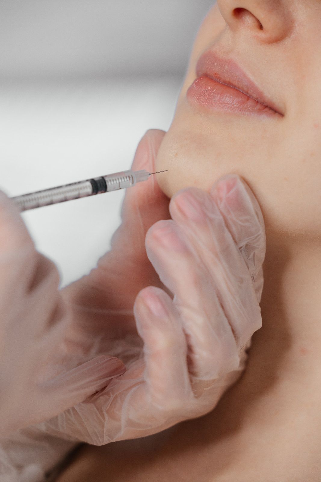How Long Does Chin Filler Take to Settle? Timelines and Aftercare