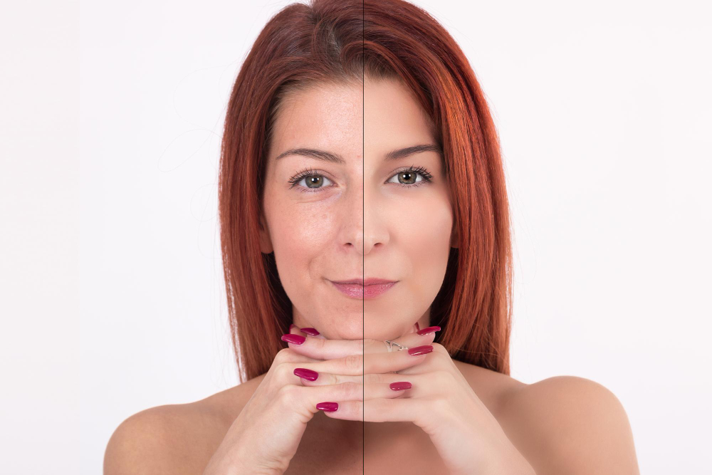 Lanluma Before and After Face Transformation